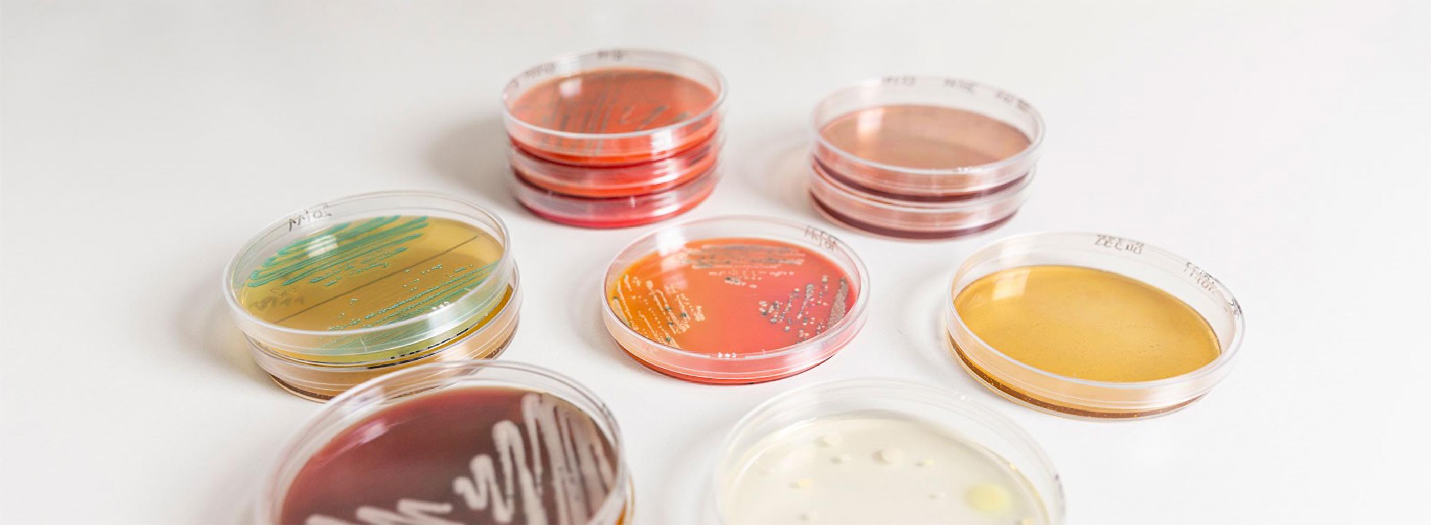 Microbiological Testing | Lab Analysis